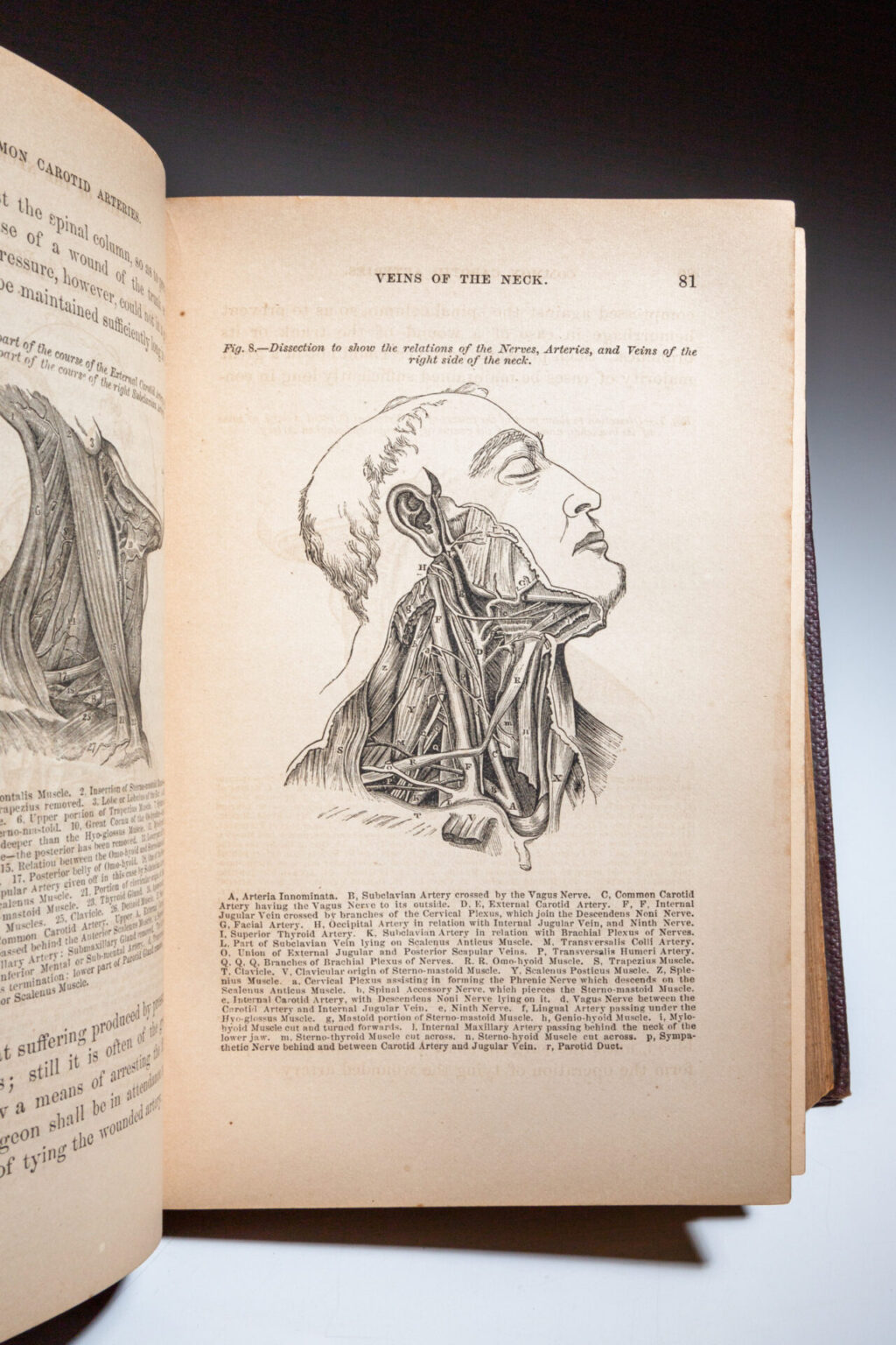 Anatomy Of The Arteries Of The Human Body - The First Edition Rare Books